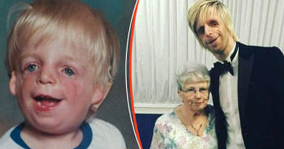 La increíble historia de Jono Lancaster es una inspiración para todos