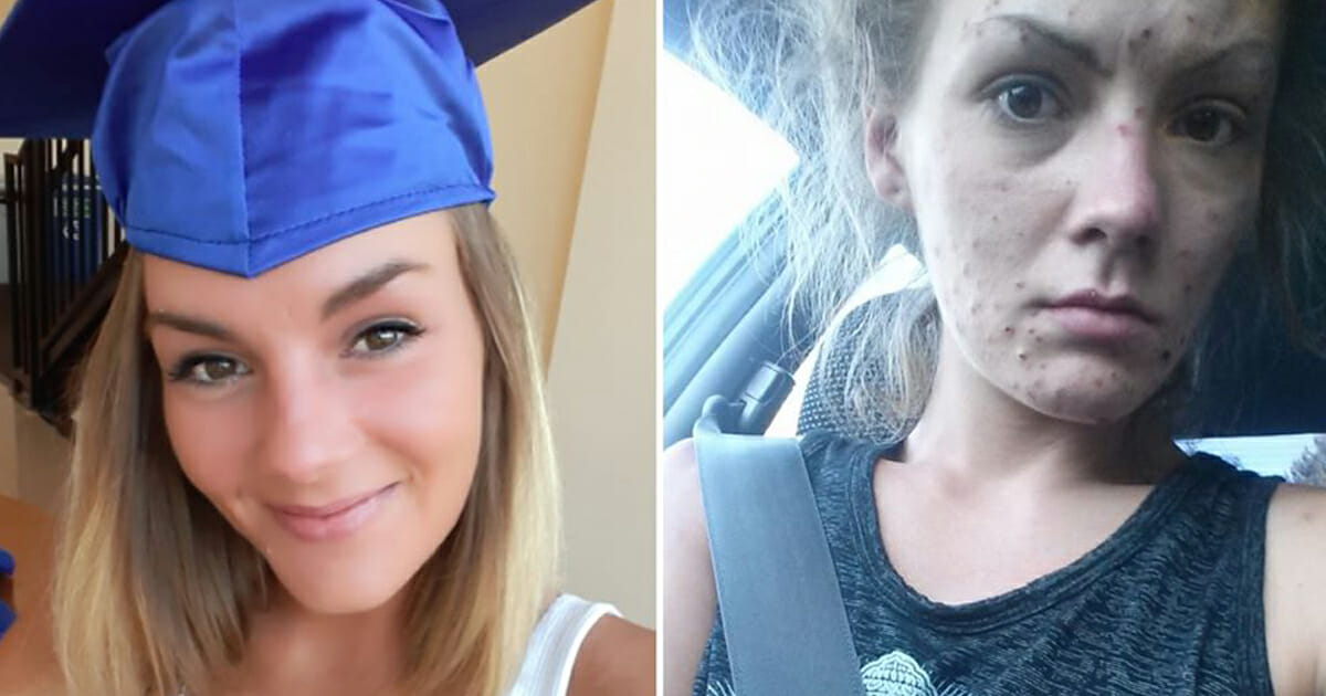 Recovering meth addict shares incredible before and after photos