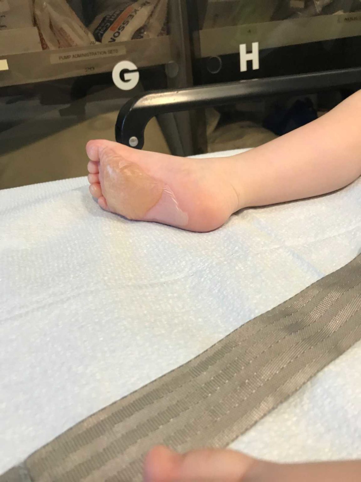 Dad of four issues warning for parents after toddler's feet "melted"
