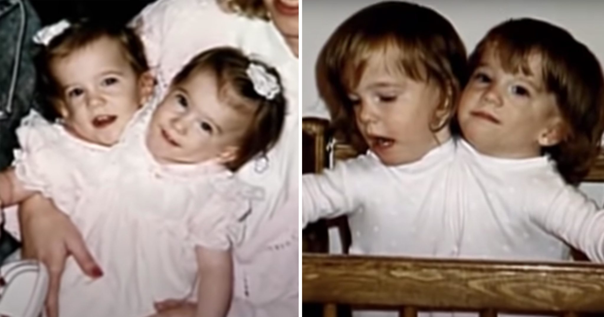 Abby and Brittany Hensel: Conjoined twins are now 4th-grade teachers