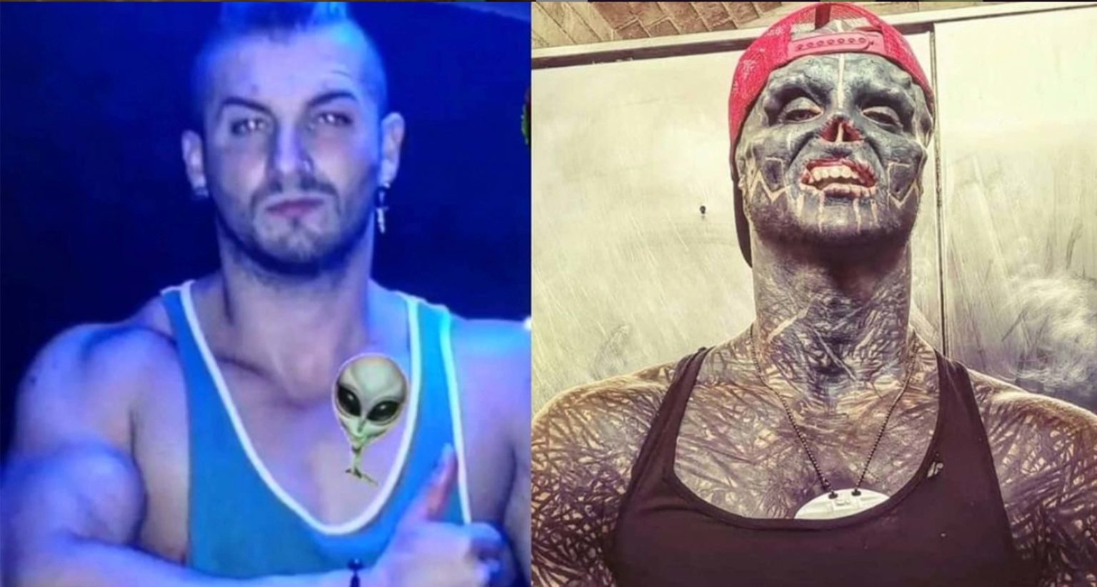 Person dubbed ‘World’s most modified man’ removes two fingers as he ...