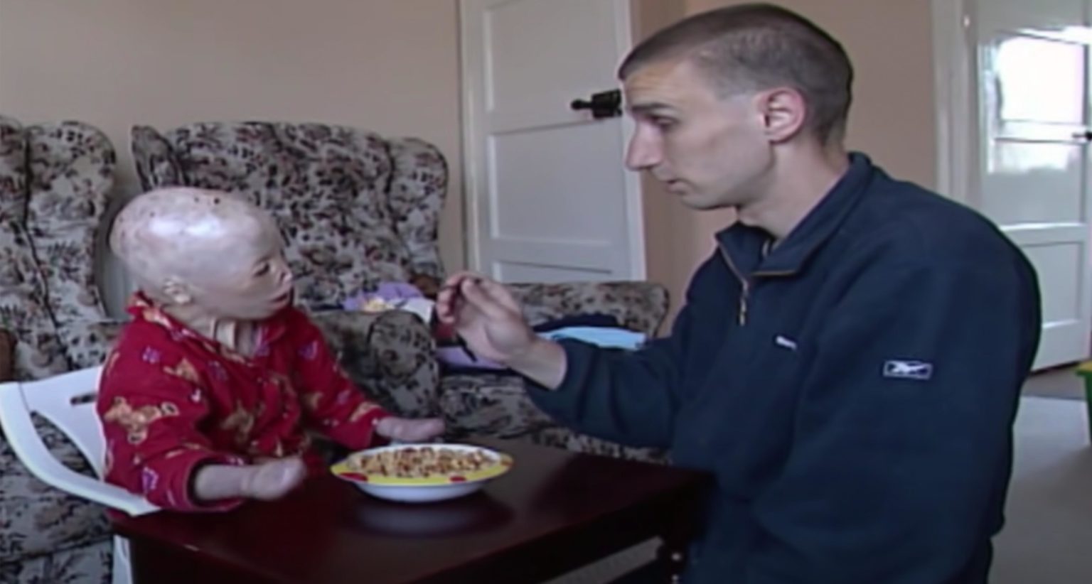 Terri Calvesbert survived fire against all odds – here's her today
