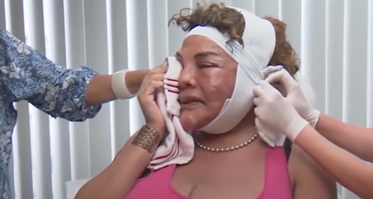 What “Cement Face” lady looks like 21 years later - Daily Cuteness