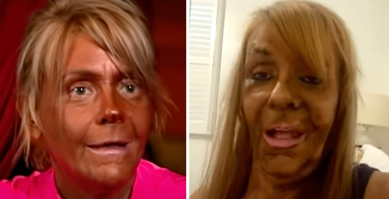 What Patricia “Tan Mom” Krentcil Looks Like Now - Weveryday Stories