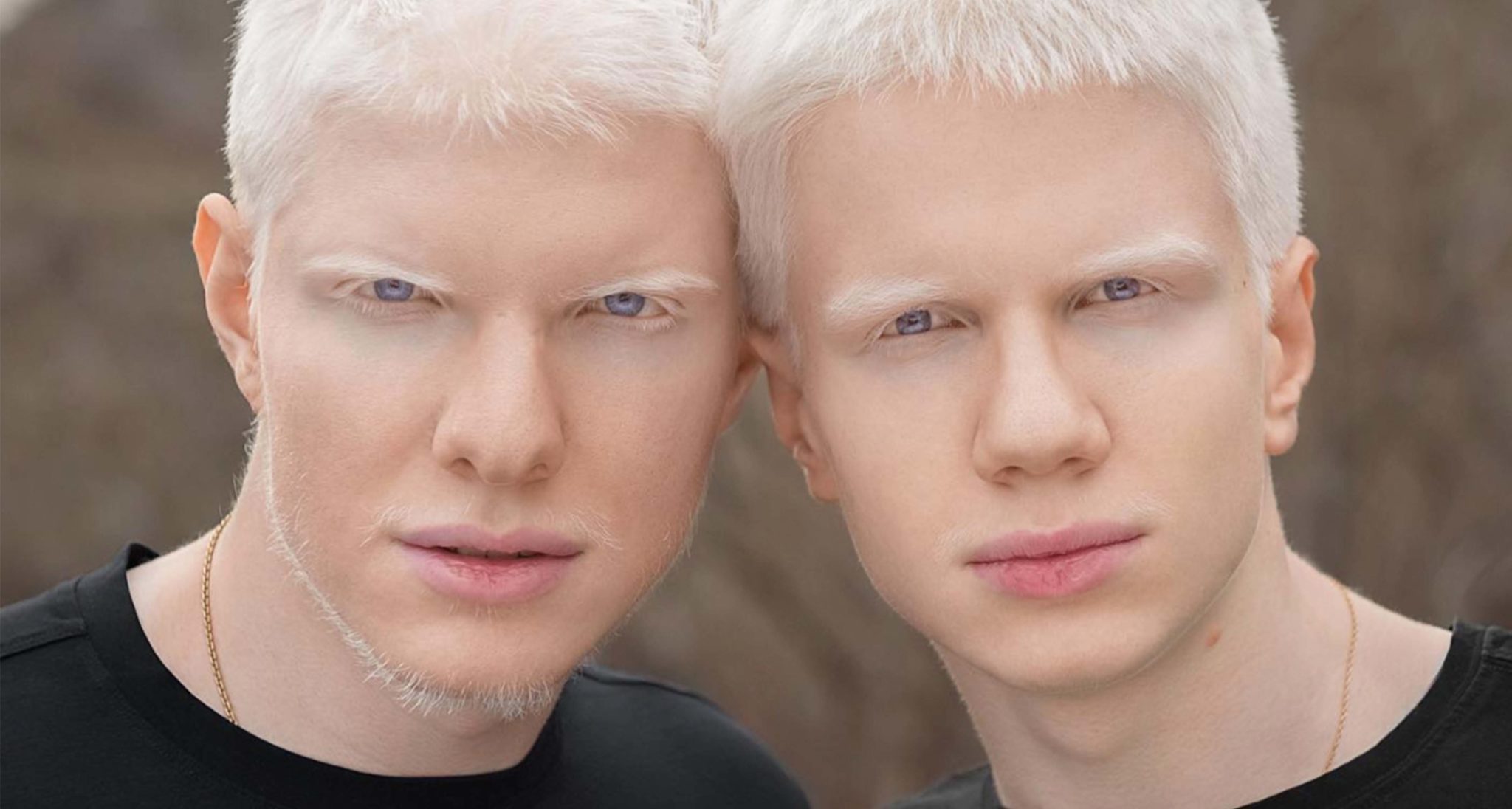 Bera Ivanishvili and brother Tsotne – this is the albino brothers today