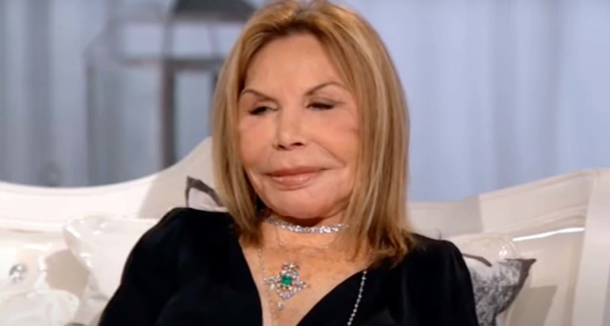 Elsa Patton had a shocking plastic surgery journey: Inside the procedures