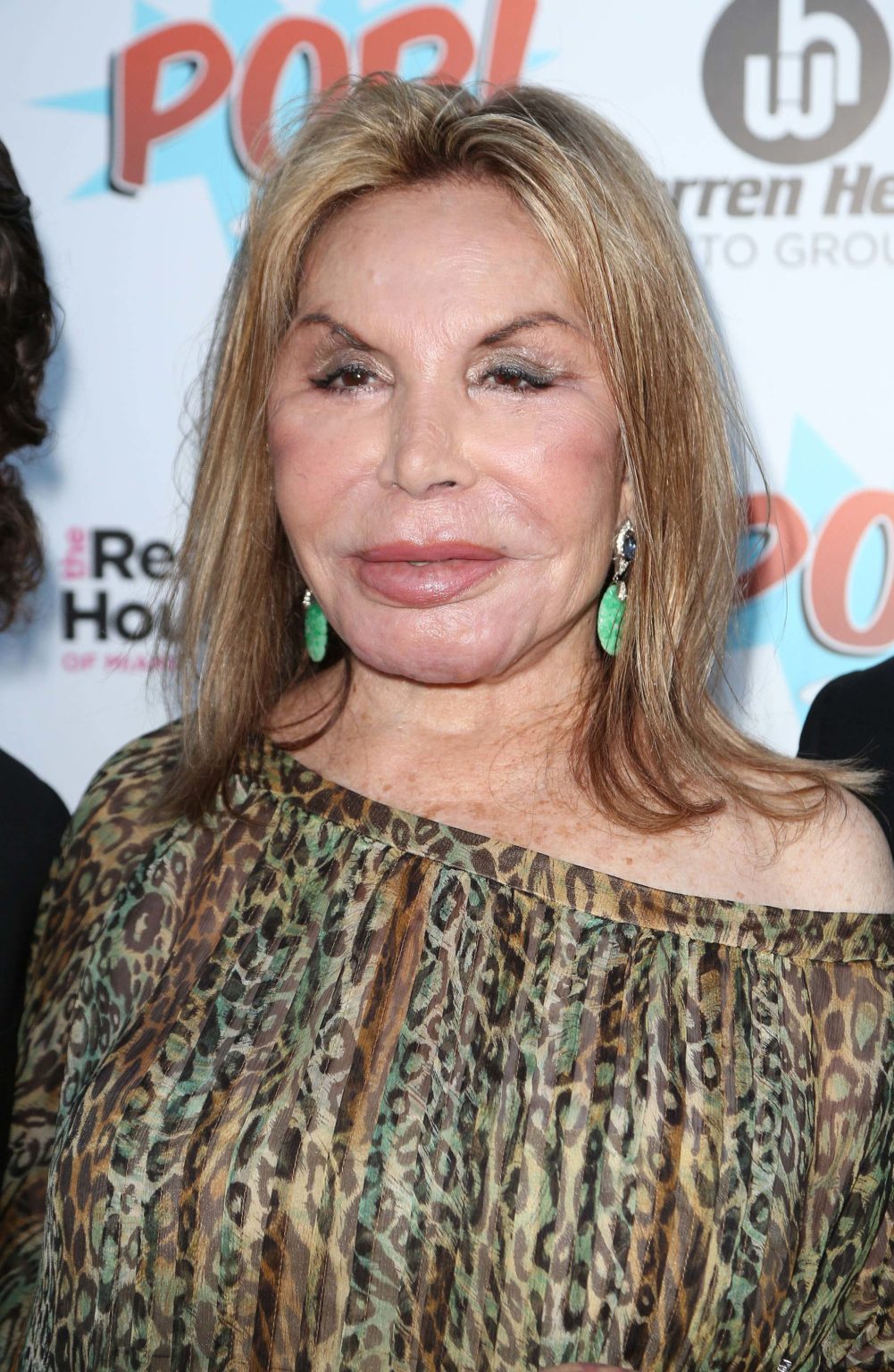 Elsa Patton had a shocking plastic surgery journey: Inside the procedures