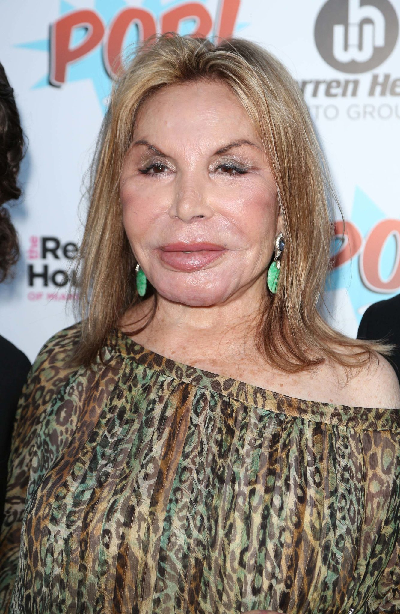 Elsa Patton had a shocking plastic surgery journey: Inside the procedures