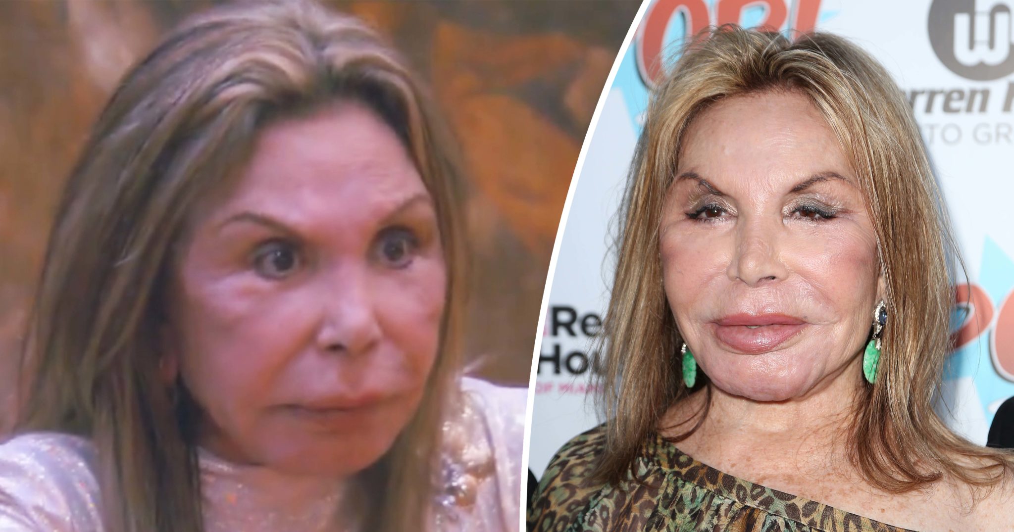 Elsa Patton had a shocking plastic surgery journey: Inside the procedures