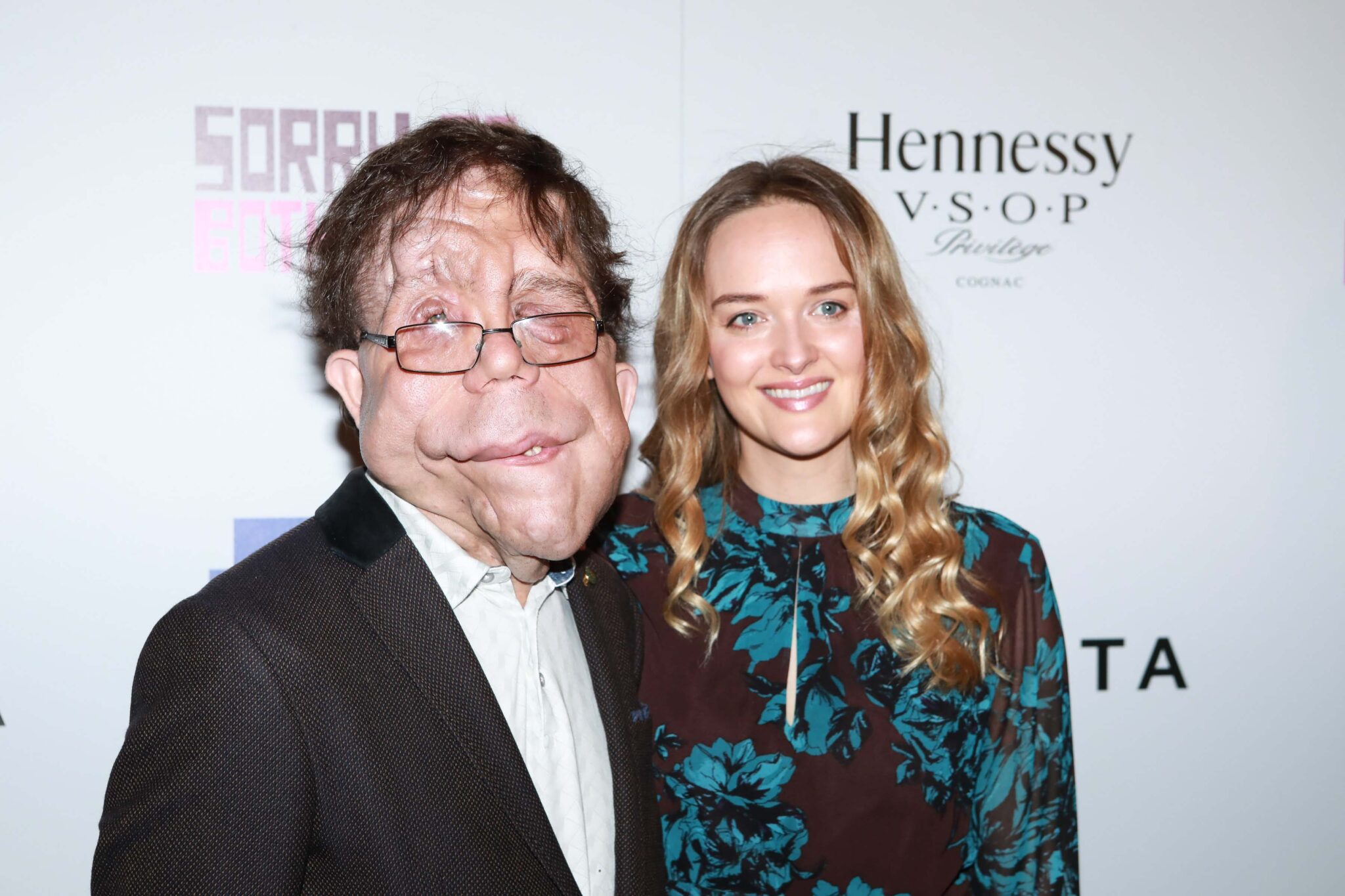 The incredible story of Adam Pearson: He became a movie star despite ...