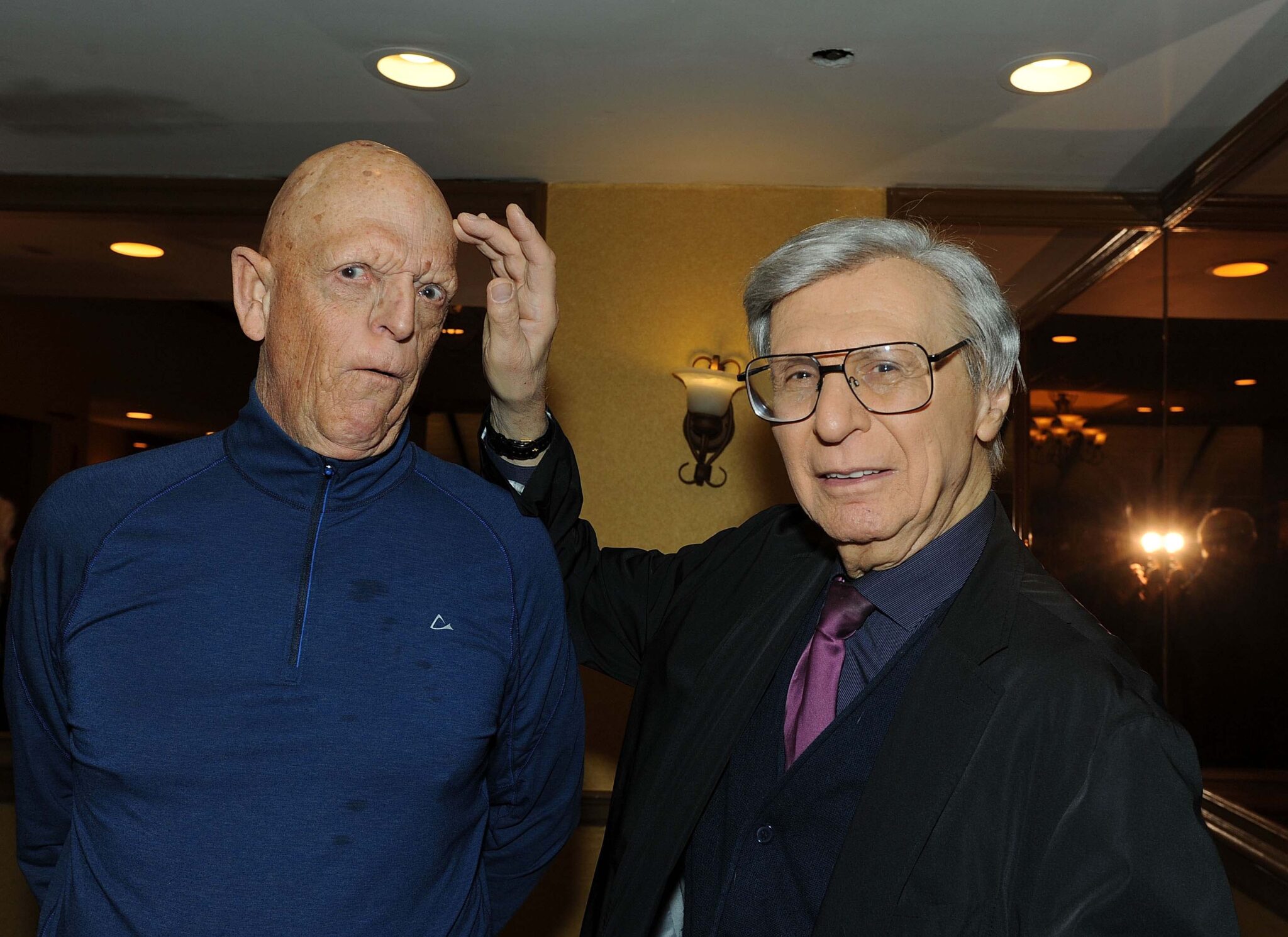 Michael Berryman became an actor despite his rare congenital disability ...