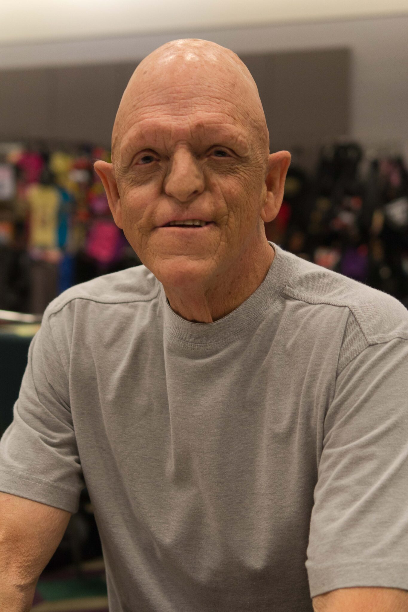 Michael Berryman became an actor despite his rare congenital disability ...
