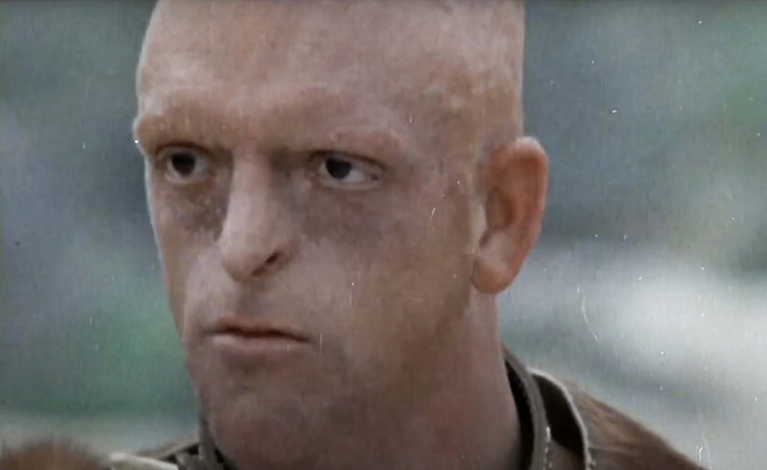 Michael Berryman became an actor despite his rare congenital disability ...