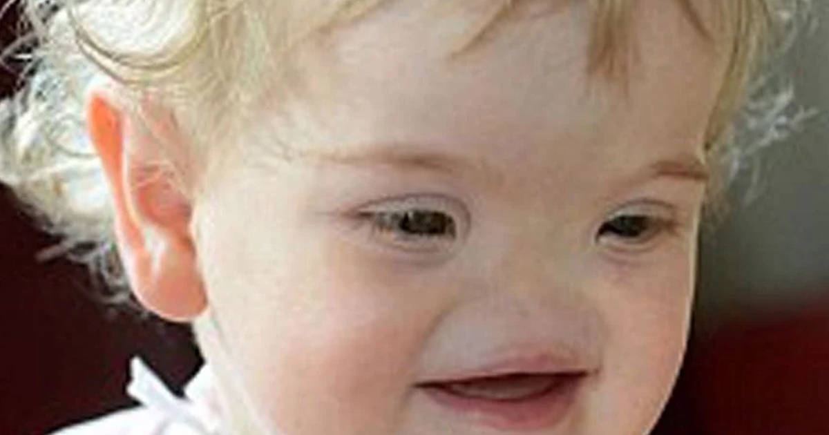 Born without a nose, here’s what Tessa Evans looks like at 12