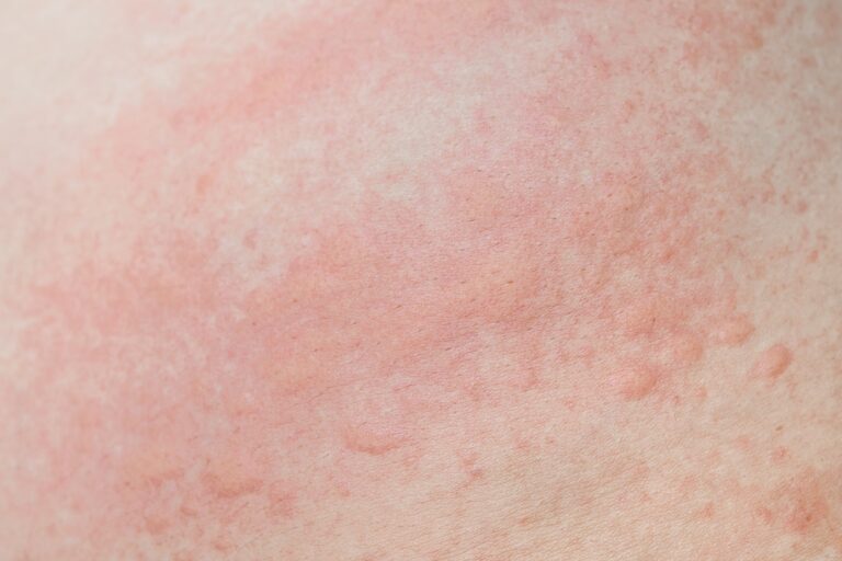 If you spot these red dots on your skin, here's what they mean