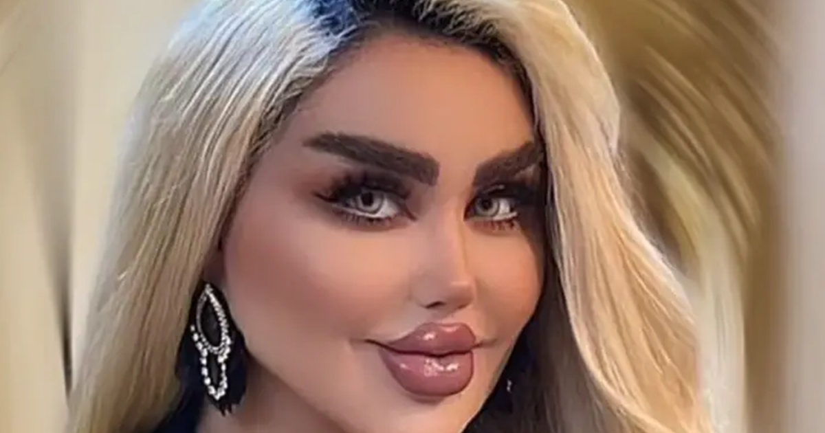 Jessica Alves, the human barbie – this is what she looks like today