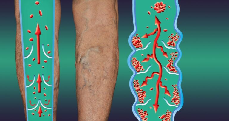 Experts reveal red flag leg symptom of deadly cancer