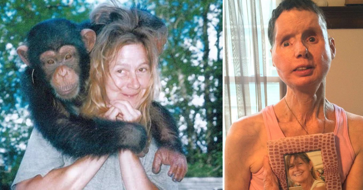 Story of Charla Nash, whose face was ripped off by an chimpanzee