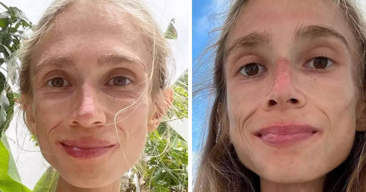 Woman starved to death in hotel room on 'fruitarian' diet