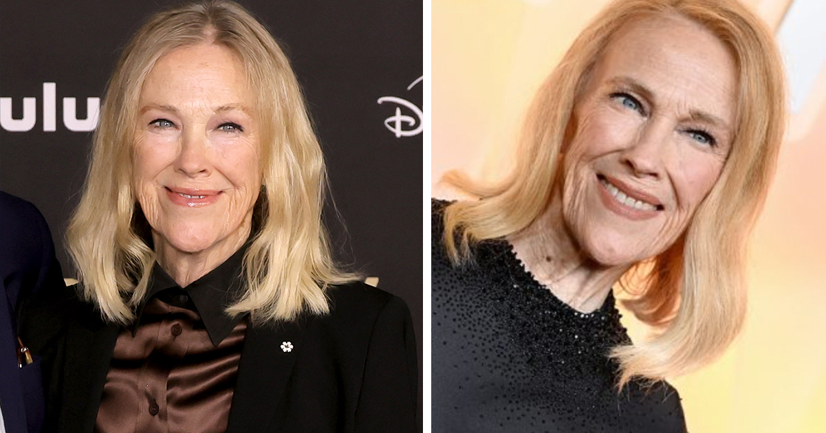 Catherine O’Hara's rare condition that flipped her organs around
