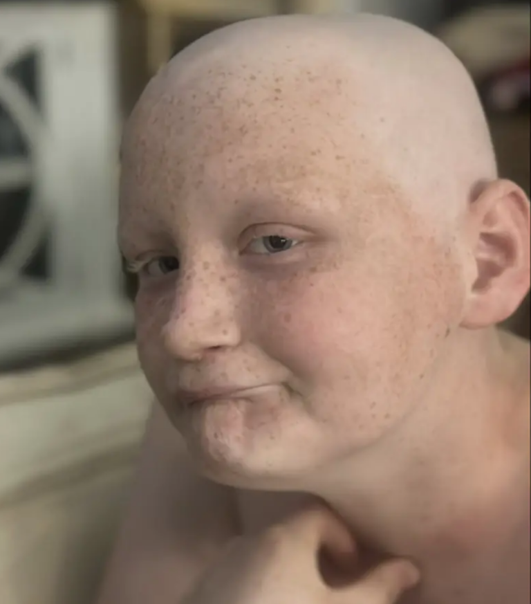 Boy, 15, battling cancer sends urgent plea using mom's Facebook