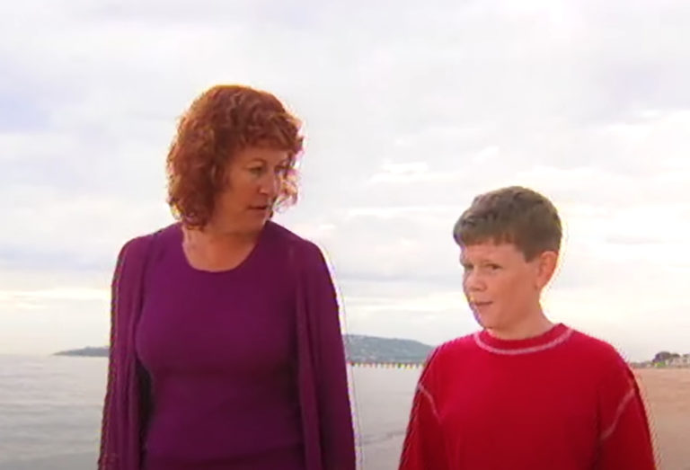 Tomm Tennent: Wyjątkowe dziecko, które urodziło się z ilością skóry ...