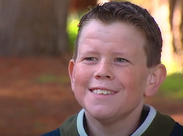 Tomm Tennent: Wyjątkowe dziecko, które urodziło się z ilością skóry ...