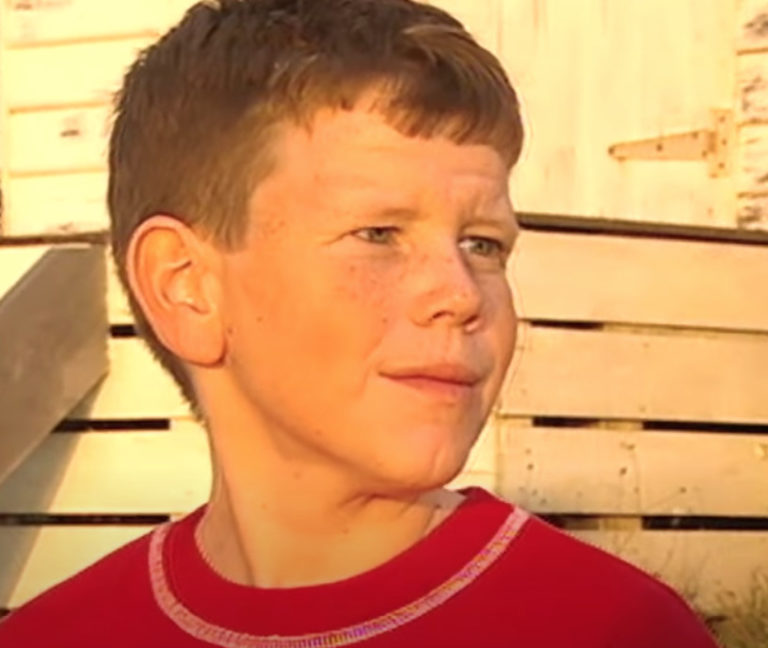 Tomm Tennent: Wyjątkowe dziecko, które urodziło się z ilością skóry ...