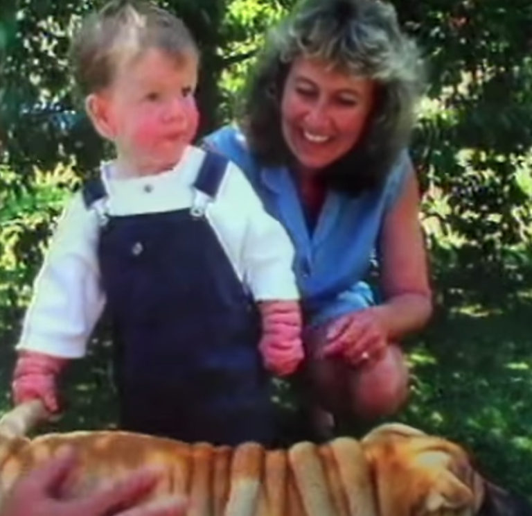 Tomm Tennent: Wyjątkowe dziecko, które urodziło się z ilością skóry ...