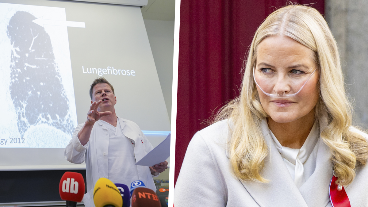 Mette-Marit sai uudet keuhkot nopeasti: asiantuntija kertoo, miksi