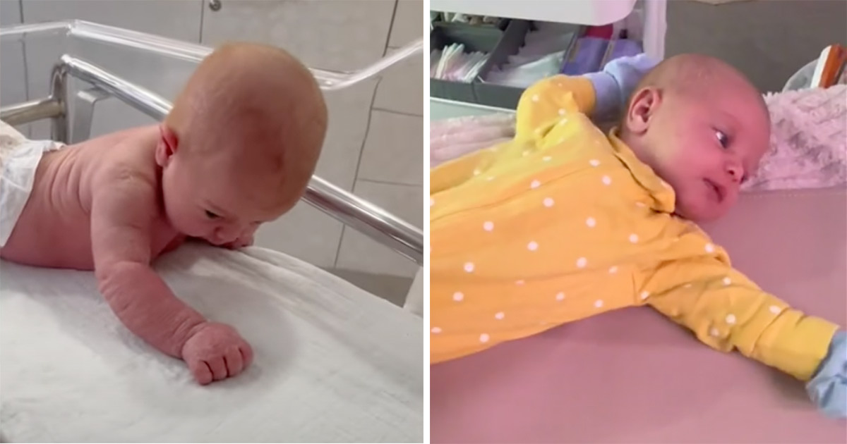 Mirakelbabyen skriver historie – se øjeblikket hvor hun kryber kun 3 ...