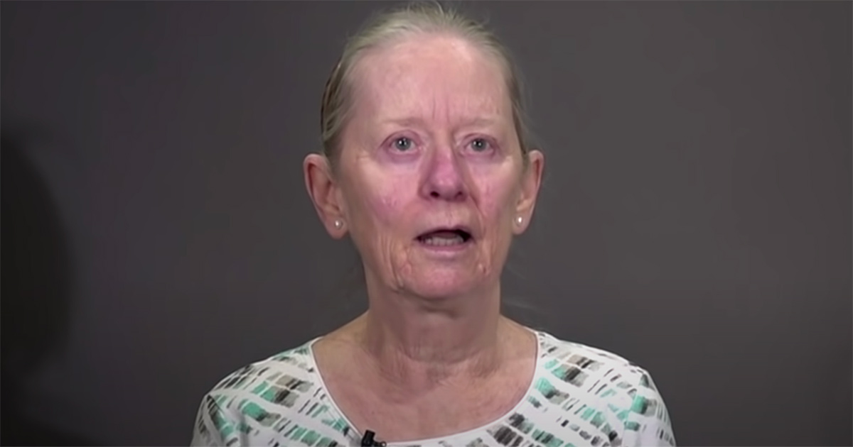 70-jährige bittet um Verjüngungskur - Ergebnis ist verblüffend