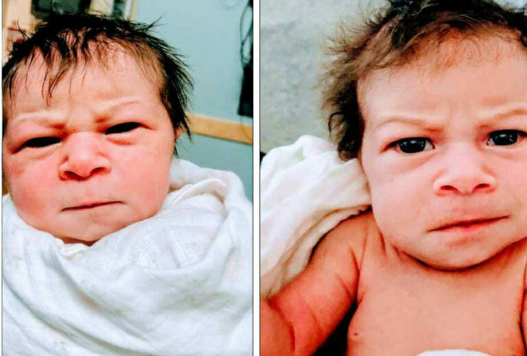 Moeder bevalt van "boze" baby, maar is zo dankbaar na Oligohydramnion ...