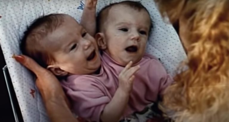 Siamese tweeling die wereldberoemd werd geeft nu les op een basisschool