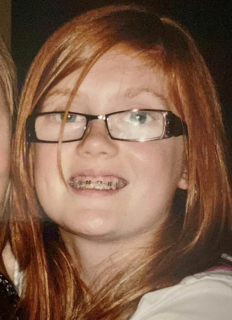 Meisje werd bespuugd om rode haar - hoe ze er vandaag de dag uitziet ...