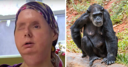 Le drame de Charla Nash : défigurée par un chimpanzé