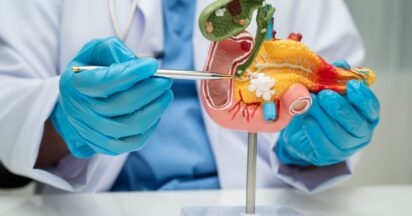 Cancer du pancréas - Lisez les articles à propos des dernières ...